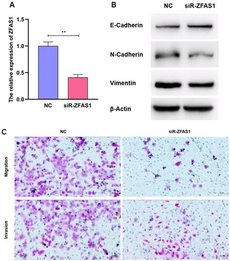 Metastasis Related Long Non Coding Rnas Al Sh Bp As And Zf
