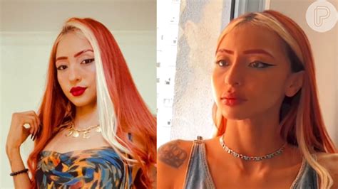 Foto Ruivinha De Marte Antes E Depois Da Harmoniza O Facial Purepeople