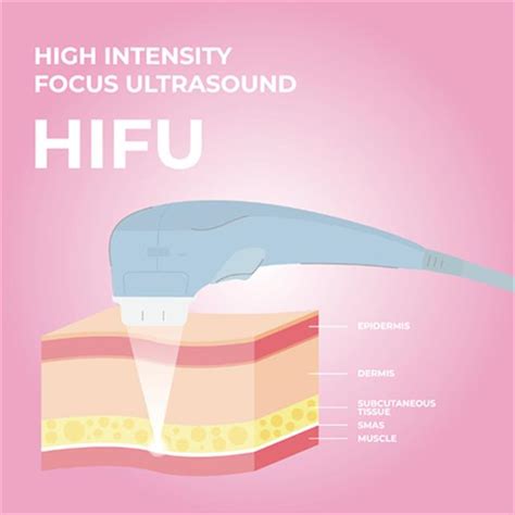 High Intesity Focused Ultrasound HIFU Siansonic Technology