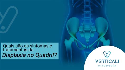 DOR NO QUADRIL O QUE PODE SER QUAIS SINTOMAS VOCÊ DEVE REPARAR
