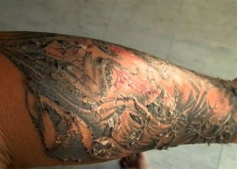 Tattoo Healing Process Stages Day By Day Aftercare Timeline 2021