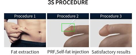 Penis Enlargement Before And After Telegraph