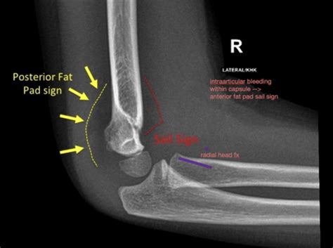 Intro To Radiology Flashcards Quizlet