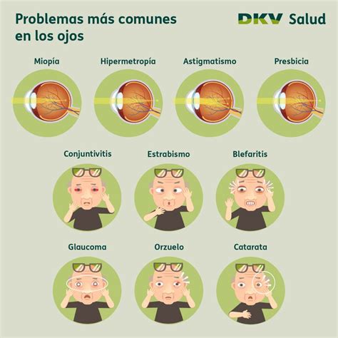 Problemas En Los Ojos En Optica Y Optometria Salud Visual