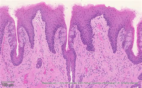 Tongue Histology Slide Labeled