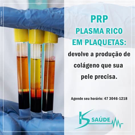 Plasma Rico em Plaquetas Conhece este técnica kssaude br