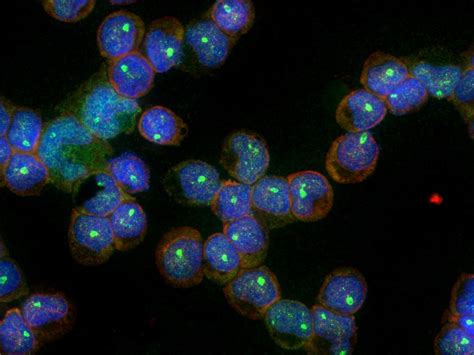 Non Specific Nuclear Staining With Immunofluorescence Microscopy