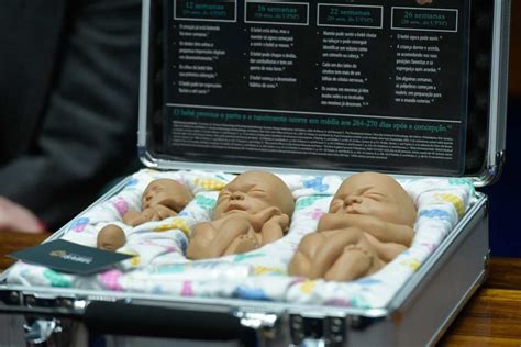 Sess O Sobre Assistolia Fetal No Senado Tem Encena O E Simula O De Aborto