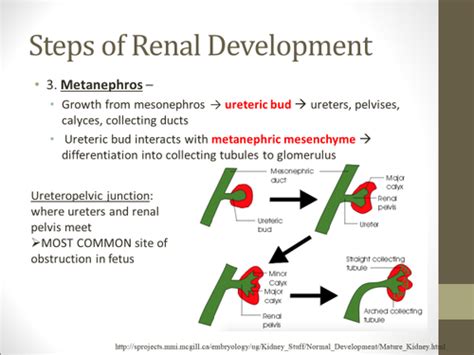 Lecture 7 Peds Renal Flashcards Quizlet