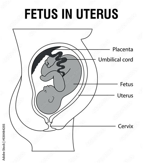 Fetus In Uterus During Pregnancy Placental Locations Pathology