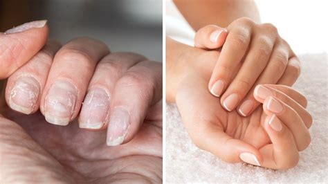 Aprender acerca 90 imagen como quedan las uñas despues del acrilico