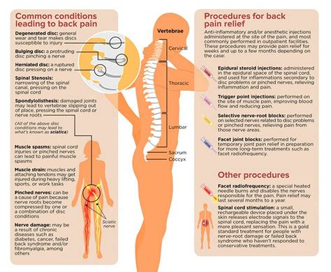 Lower Back Pain Diagnosis Chart
