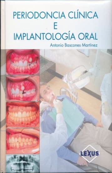 Periodoncia Clinica e Implantología Oral MEDILIBRO