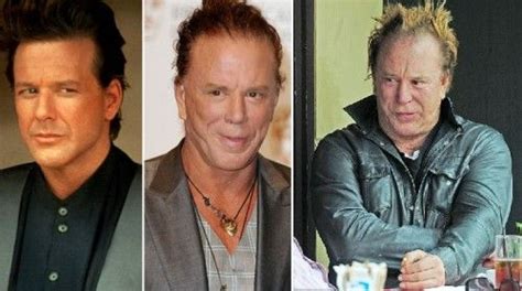 Bad Plastic Surgery Celebrity Men Gone Too Far Plastic Surgery Bad