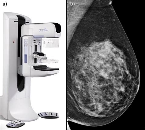 A Shows A Modern Mammography Unit Hologic Selenia Dimensions B