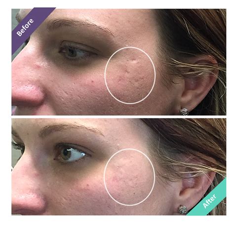 How To Make Scars With Makeup Legacy Teapigs Co Uk