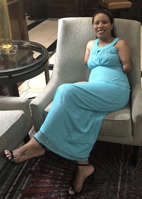 Pregnant Amputees
