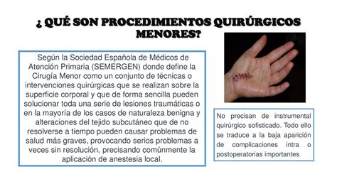 Procedimientos Quirúrgicos Menores Yessi Smith uDocz