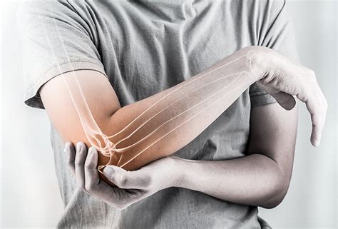 Kireçlenme Osteoartrit Urartu Göz Tıp Merkezi Van Göz Hastanesi