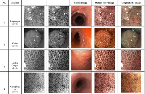 color reproduction and processing algorithm based on real time mapping for endoscopic images