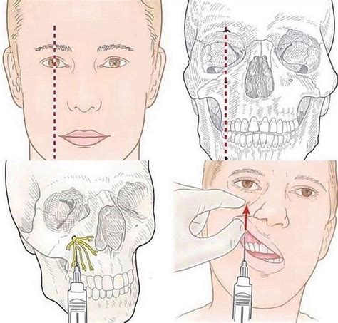 Dental Assistant Study Dental Hygiene Student Dentistry Student