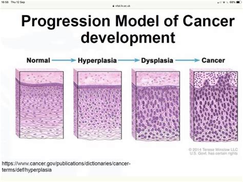5 Neoplastic Disease Of The Nervous System Flashcards Quizlet