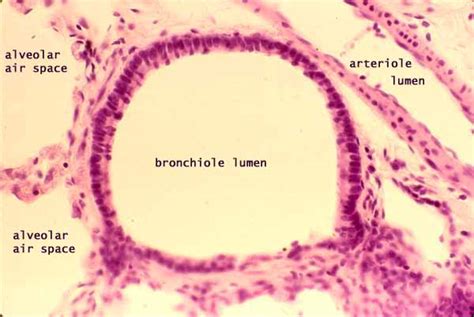 Lung Slide Labeled Bronchiole