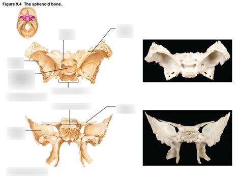 Cranium Sphenoid Bone Superior And Posterior View Diagram Quizlet