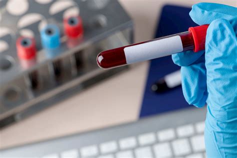 Cómo interpretar un análisis de sangre Actualidad Sanitaria