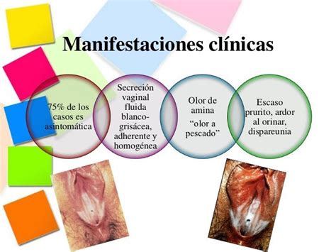 Infecciones de transmisión sexual Mind Map
