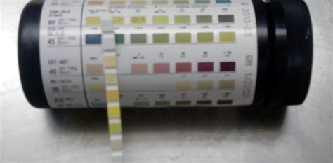 Urinalysis Flashcards Quizlet