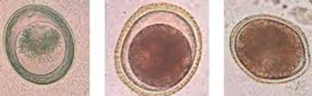 Parasitology Quiz 1 Quiz 2 Past Exam Mcqs FOR EOY EXAM