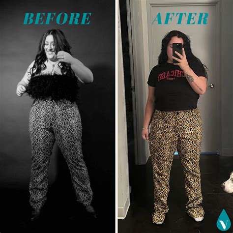 Semaglutide Success Story VIVA Wellness