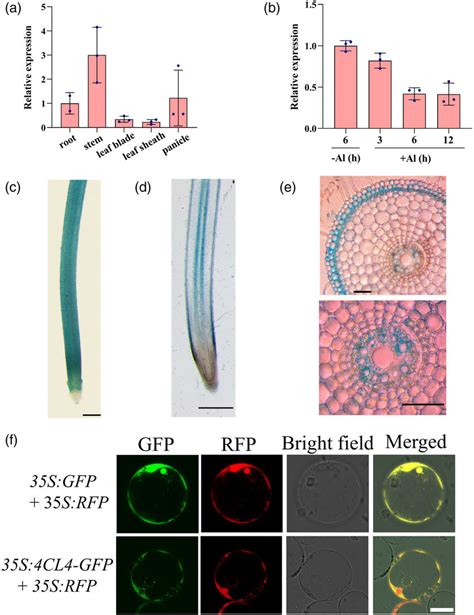 Expression Pattern And Subcellular Localization Of Cl A Expression