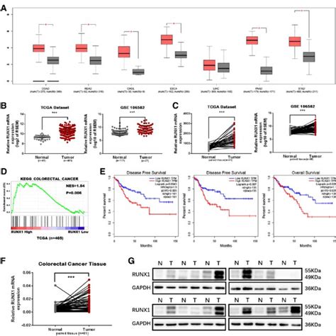 RUNX1 promotes colorectal cancer progression via RUNX1 Wnt β catenin
