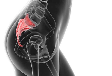 Coxis qué es por qué duele y cómo ayuda la quiropráctica