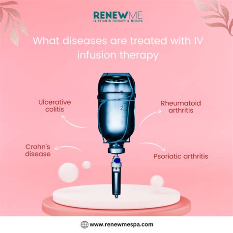 Manage Your Chronic Condition With IV Therapy In Los Angeles Best IV