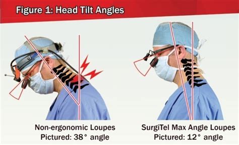 Guidelines For Selecting Clinical Loupes Ergonmic Loupes SurgiTel