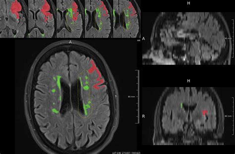 view 41 image segmentation deep learning matlab