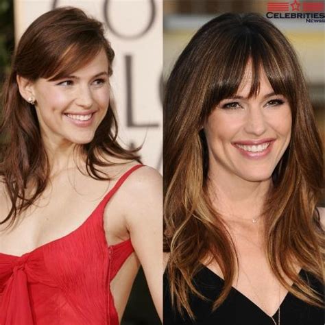 Top 21 Celebrities Before And After Veneers And Celebrity Cosmetic
