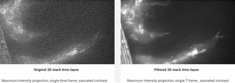 image denoising using matlab biii