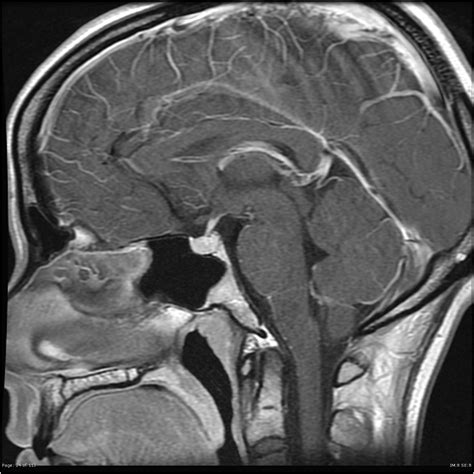 Image Radiopaedia Org