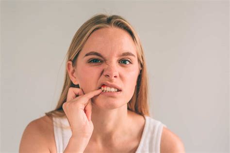 Gengiva Inflamada Quais S O As Causas E O Que Fazer Para Melhorar
