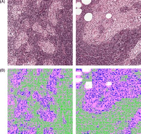 whole‐slide histopathological semantic segmentation using our method download scientific