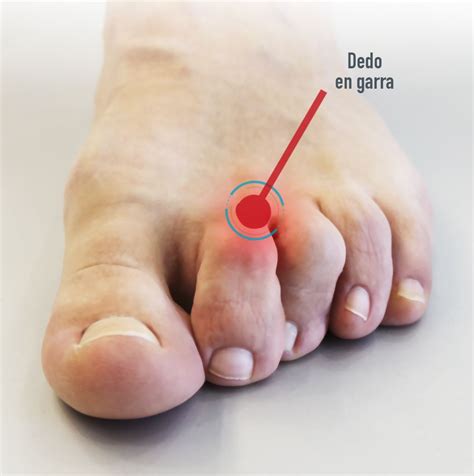 Pin en ιατρικά