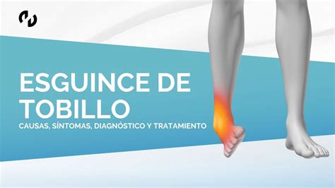 Esguince De Tobillo Causas S Ntomas Diagn Stico Y Tratamiento Youtube