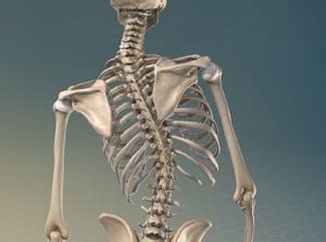 Intracept Procedure For Chronic Lower Back Pain DISC