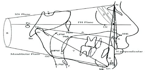 Skeletal Cephalometric Reference Planes Angular And Linear