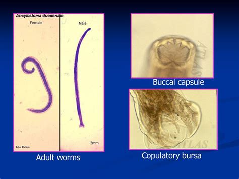 Ancylostoma Duodenale Morphology Labeled