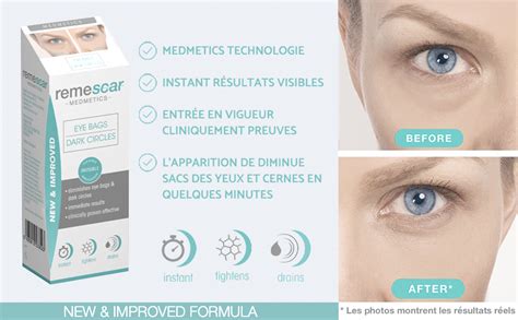 Remescar Poches et Cernes Crème 2 Neuves et Améliorées Crème